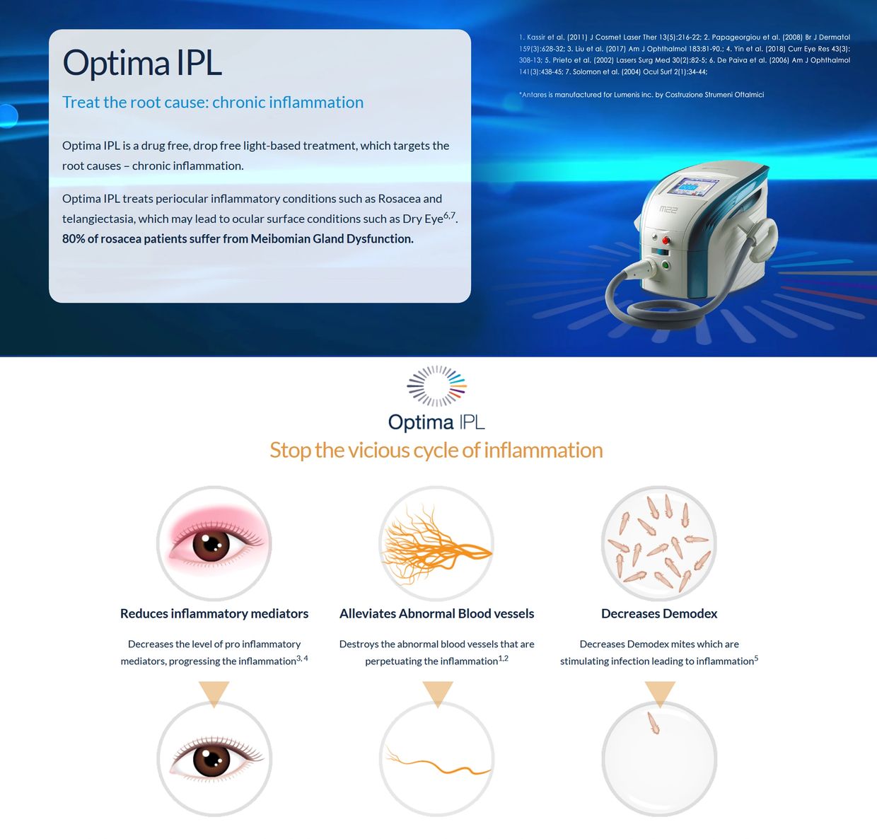 IPL DRY EYE TREATMENT